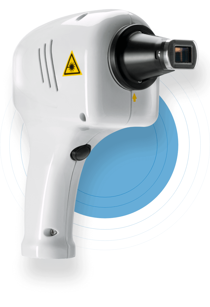 X-Lase Plus Laser Treatment in Miami - Evoskin